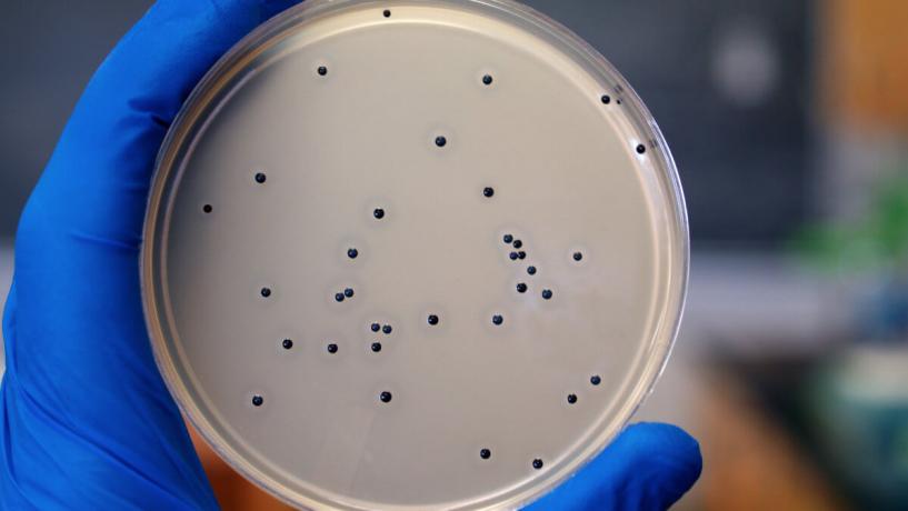 Food Poisoning Microorganisms: Top Three to Watch Out For